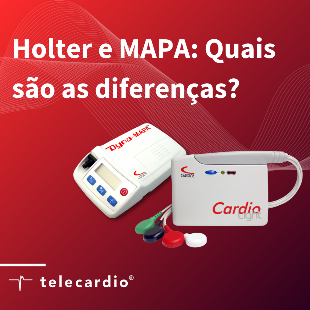 Holter e MAPA, quais são as diferenças - Telecardio
